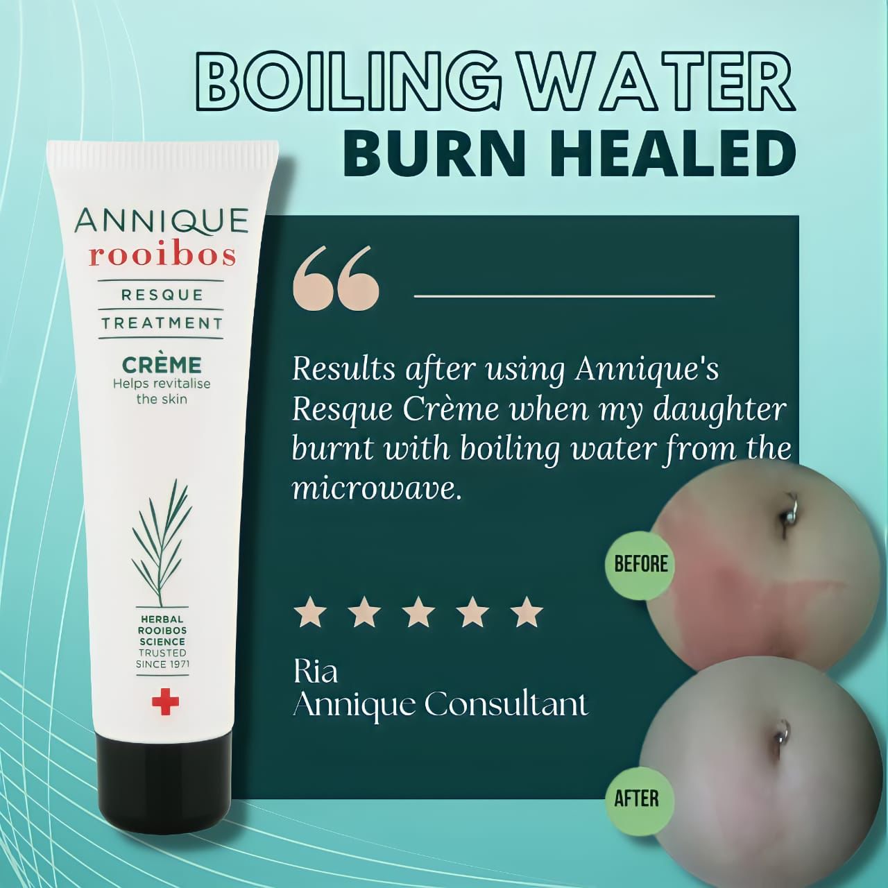 ANNIQUE Rooibos Resque Treatment Crème 30ml - Rooibos & co. – Rooibos ...